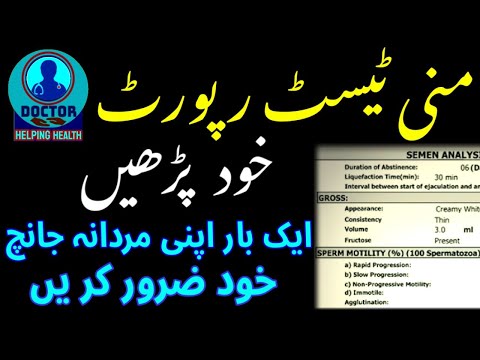 How to Read Sperm Test Report in Urdu/Hindi |Understanding Semen Analysis Result |Mani ki Report