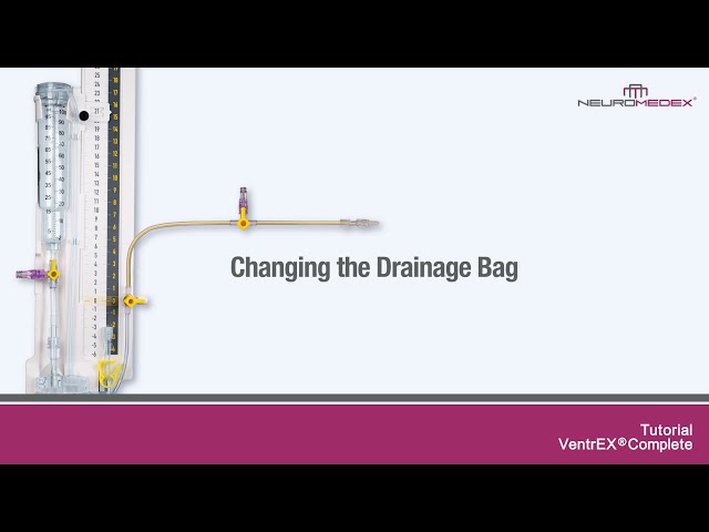 VentrEX® Complete EVD | Ventrex