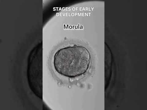 Early development of human | Cleavage | morula | blastulation
