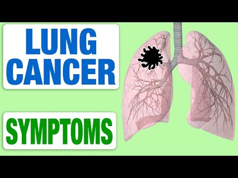 Lung Cancer - All Symptoms