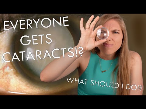 Do YOU Need Cataract Surgery? You Were Diagnosed With Cataracts--WHAT NOW?!?