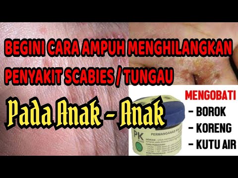 Cara Ampuh Mengobati Penyakit Scabies Tungu | Penyakit Gatal-Gatal