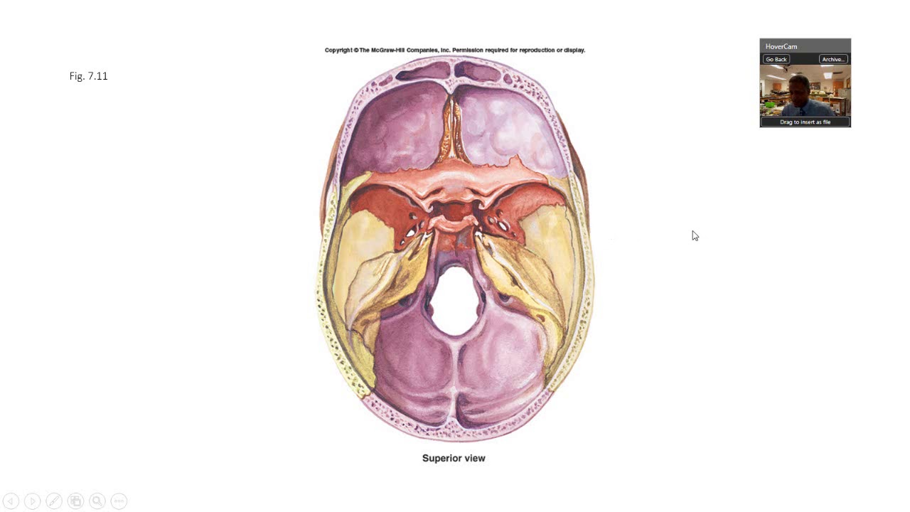 Skull Bones and Bone Markings Practice Slides