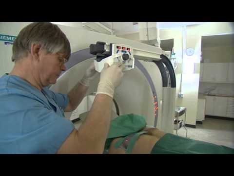 SimpliCT laser navigation system used for a CT lung biopsy