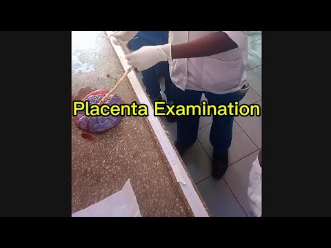 PLACENTA EXAMINATION - RETURN DEMO