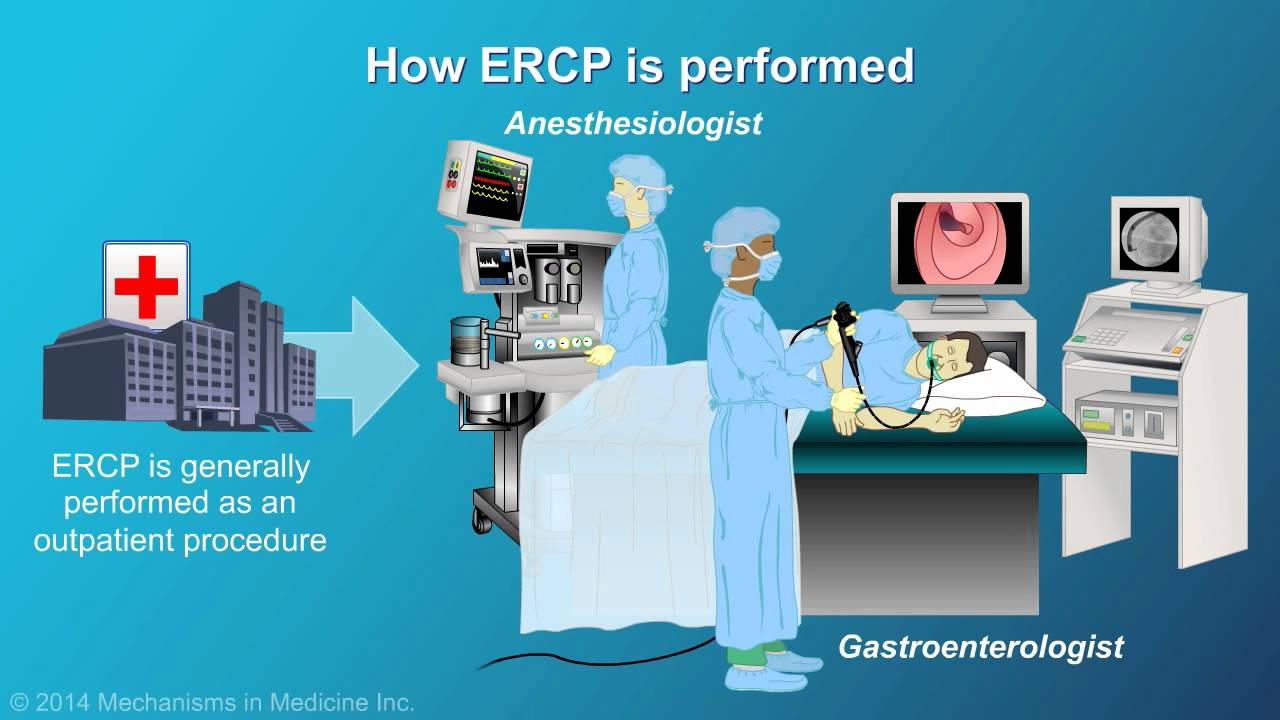Understanding ERCP (Endoscopic Retrograde Cholangiopancreatography)