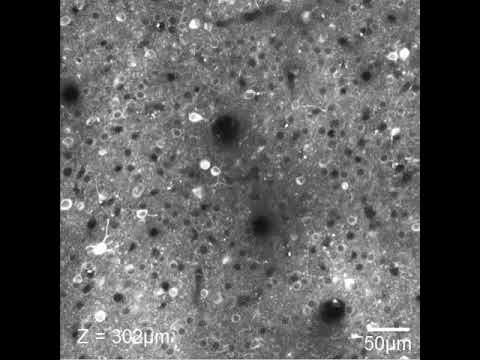 Z Series Two-Photon Imaging of V1 Neurons in Awake Monkey