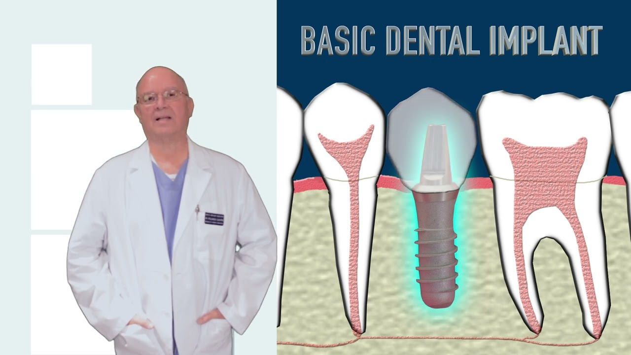 What Are Dental Implants? | Comprehensive Guide to Modern Tooth Restoration