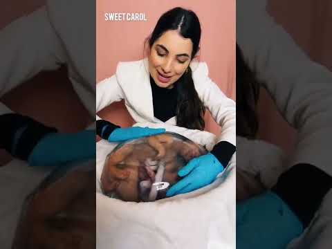 Fetus Model of the Amniotic Sac (which is mostly filled with baby pee) - Doctor Reacts #shorts