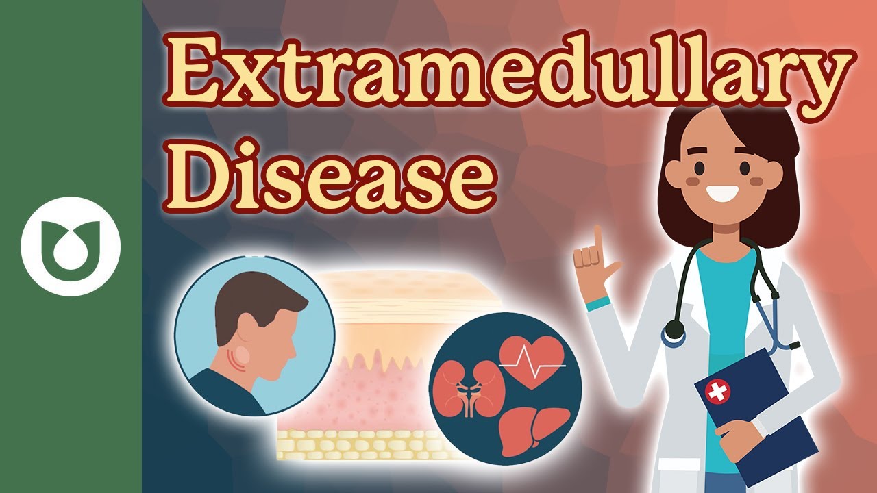 What Is Extramedullary Disease in Myeloma? | Understanding & Treatment Explained