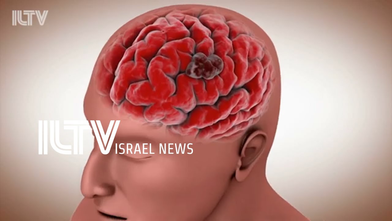 New Israeli brain cancer treatment