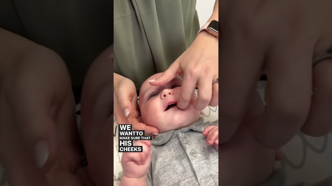 Post Tongue-Tie Release Care: Gentle Cheek Fascia Exercise #TongueTieTips #InfantCareTips