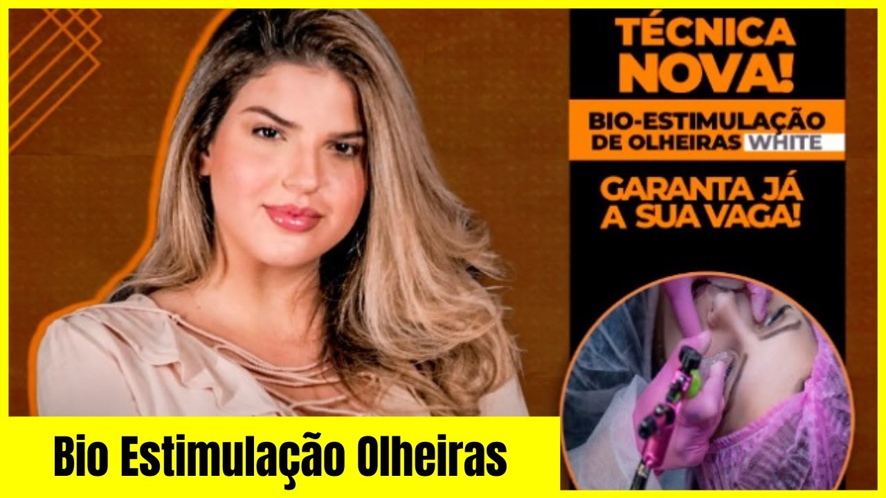 Camuflagem de Olheiras - Diferencial da Técnica Bio Estimulação Olheiras White