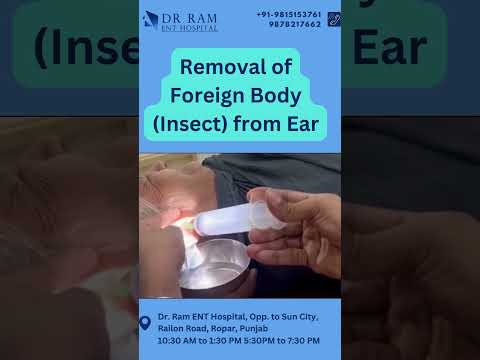 Removal of Foreign Body Insect from Ear