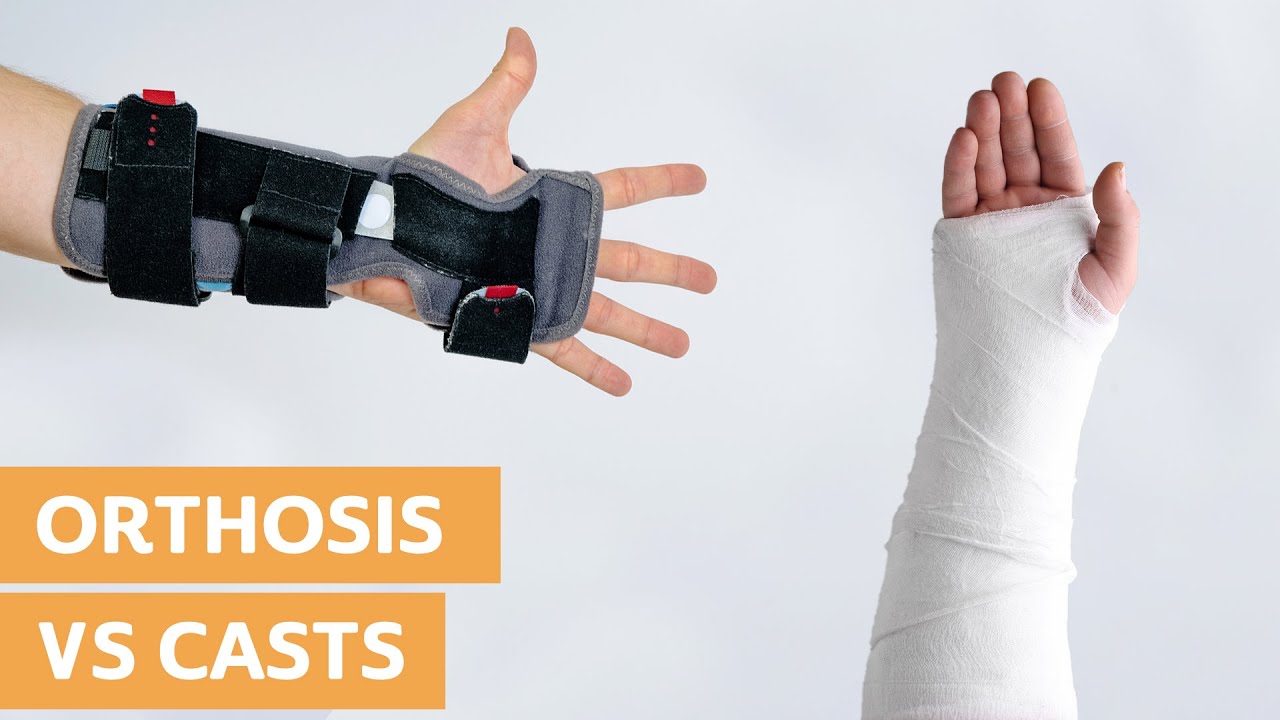 Orthosis Vs Casts