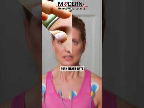 What happens during a Cardiac Stress Test?