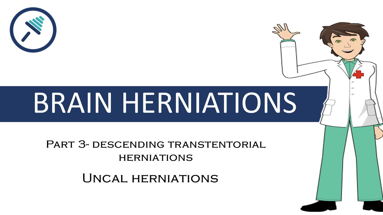 BRAIN HERNIATIONS (3/4) - Uncal herniation