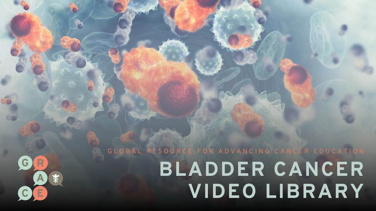 Tumor Infiltrating Lymphocytes and Tumor Associated Macrophages - Bladder Cancer Video Library