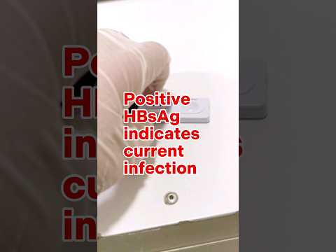 Hepatitis B Screening test #laboratory #medtechstudent #cls #mls #hepab