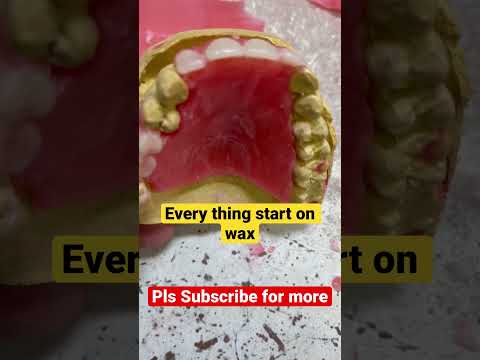 How To Make Partial Dentures: A Quick and Easy Guide