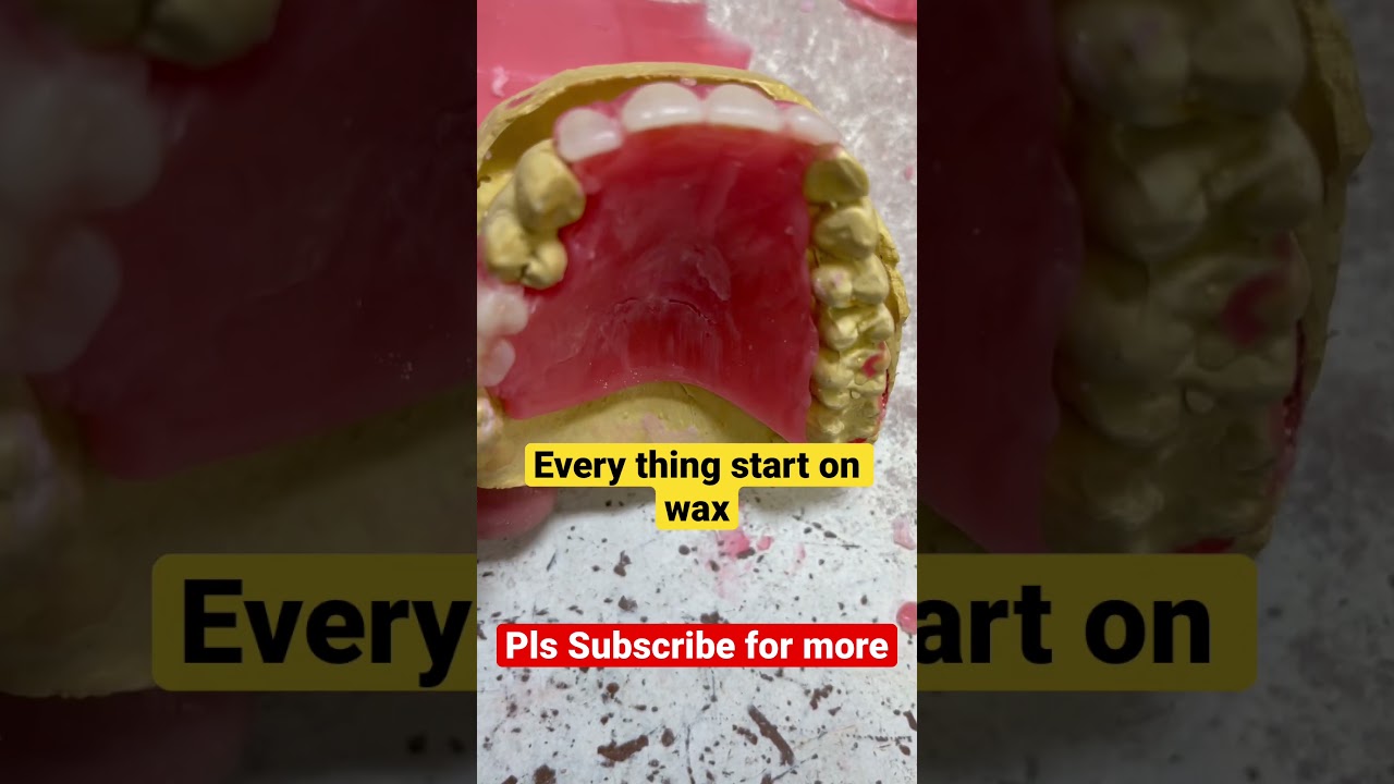 How To Make Partial Dentures: A Quick and Easy Guide
