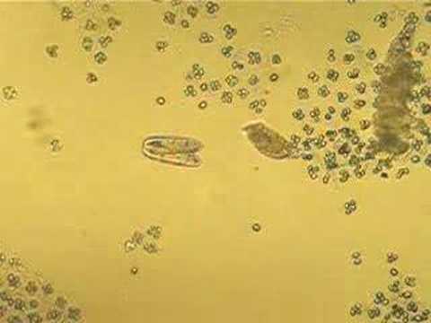 Paramecium caudatum in conjugation