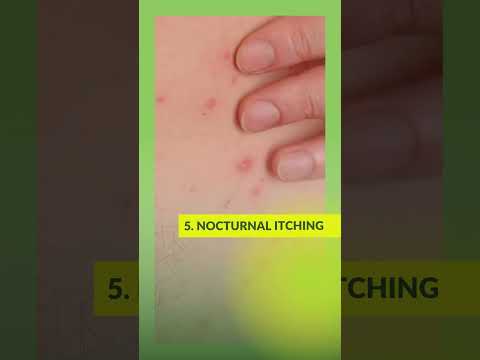 10 Early Signs of Bed Bugs Bites #bedbugs #bedbugsbites #bedbugssigns