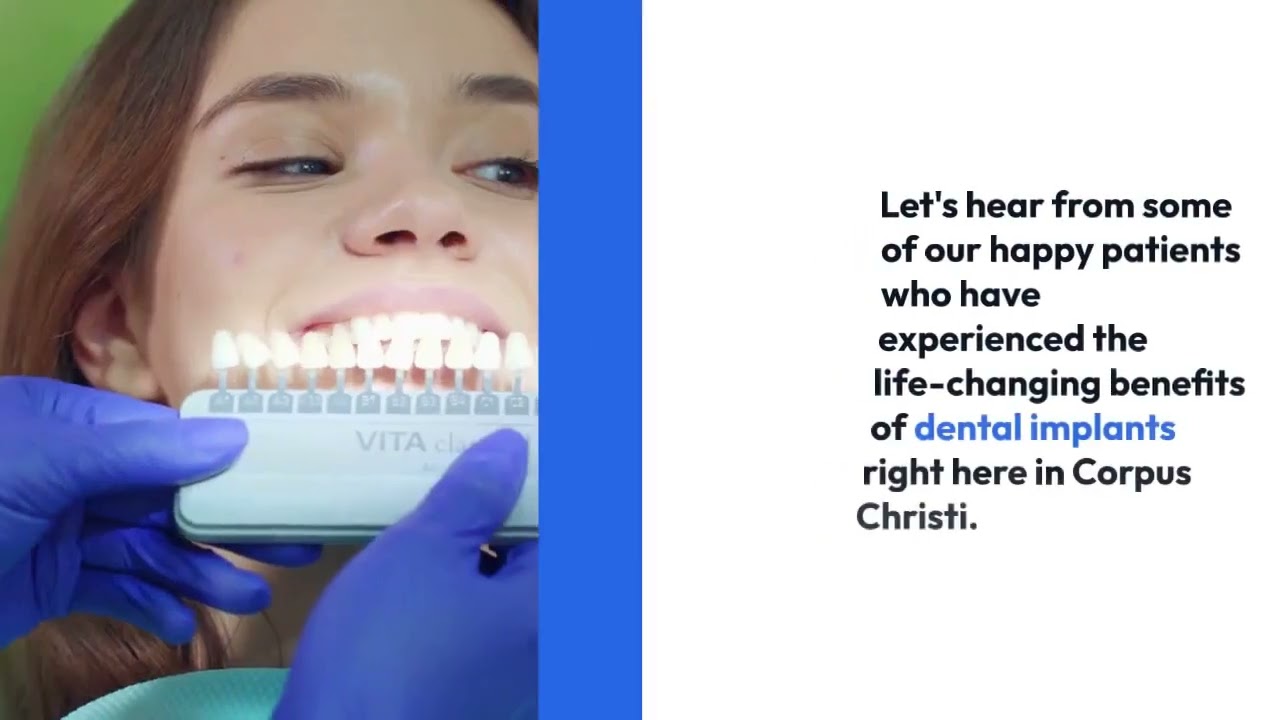 Revolutionize Your Smile: The Ultimate Guide to Dental Implants in Corpus Christi | Tide Dental