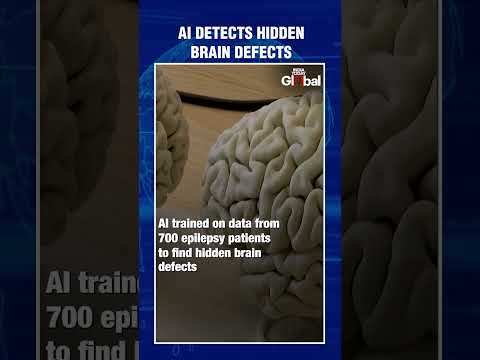 AI Breakthrough: Detecting Hidden Brain Abnormalities Causing Epilepsy