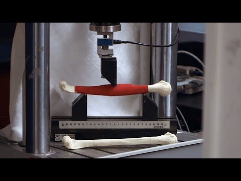 Research at the Orthopaedic Trauma Institute at UCSF/Zuckerberg San Francisco General