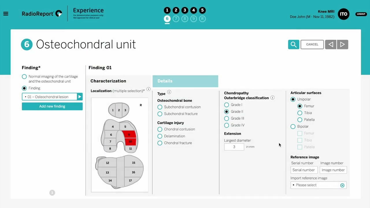 Practical Guide to Knee MRI Reporting with RadioReport®