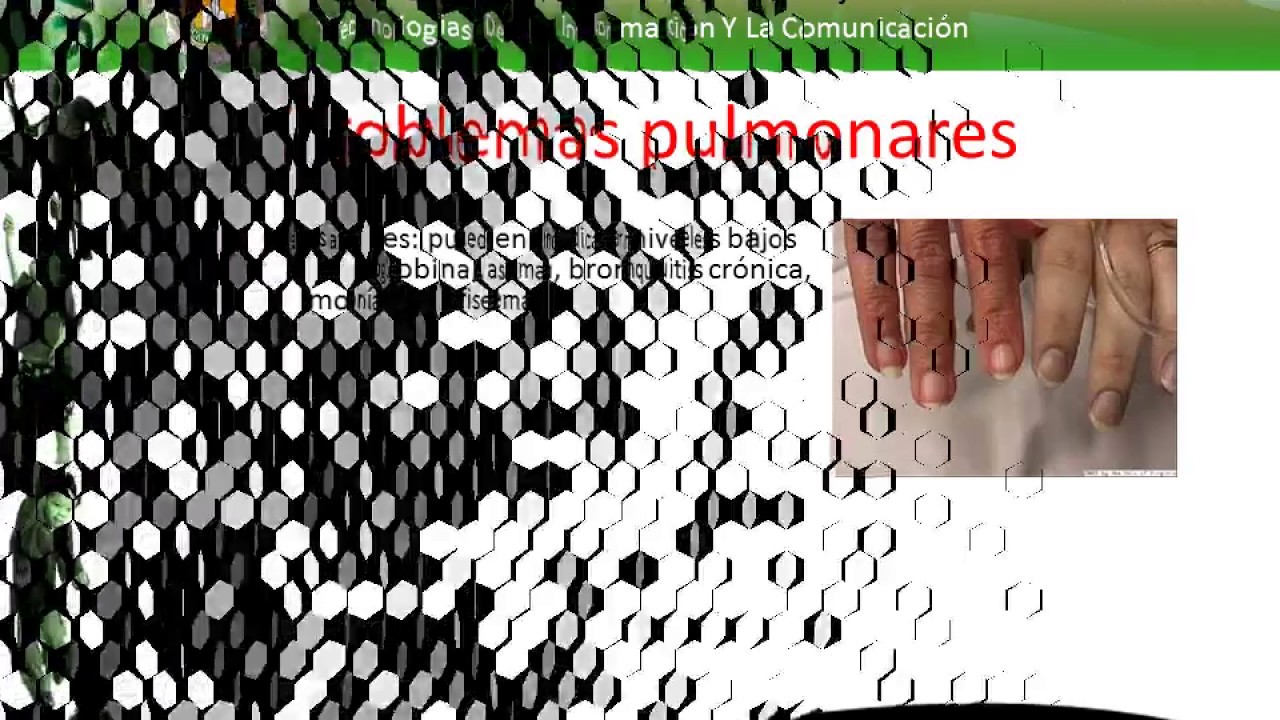 Ramirez Alejandra VPPT