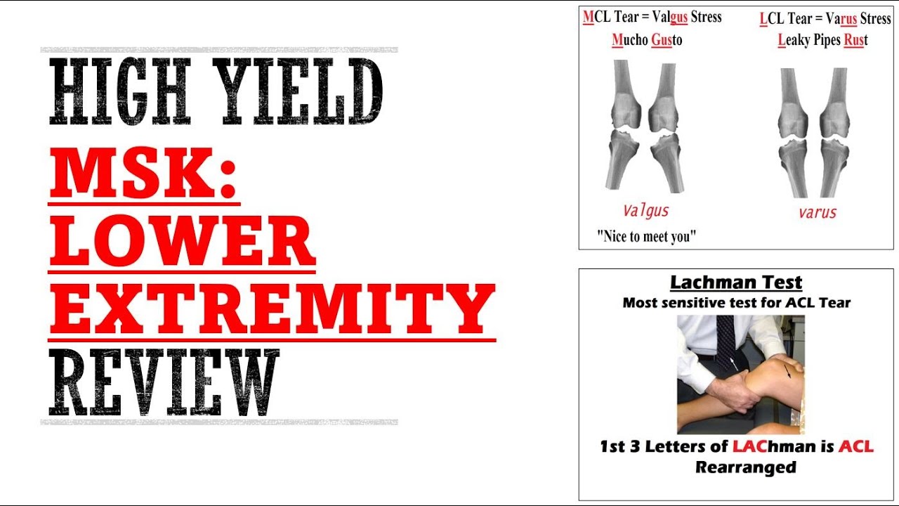 Essential MSK Lower Extremity Review: Key Concepts and Mnemonics for ...