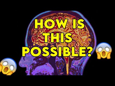 4 Brain injuries that gave new abilities😱😱
