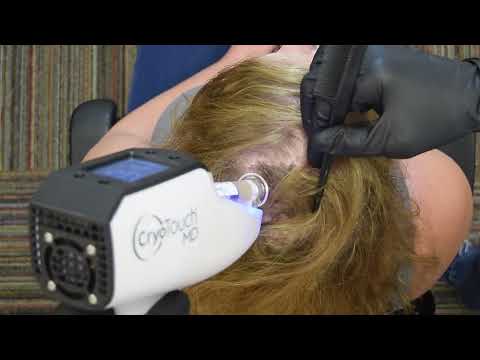 TrichoCyte Long Hair Application Protocol