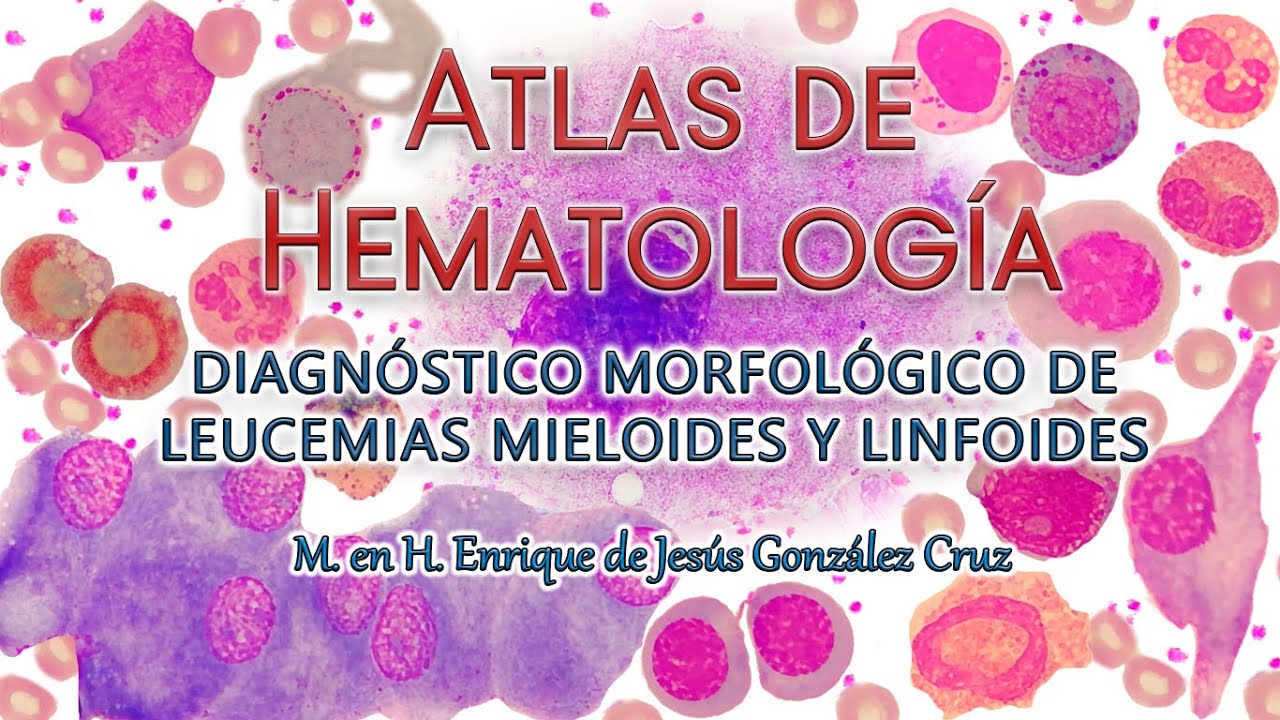 ATLAS INTERACTIVO DE HEMATOLOGÍA DIAGNÓSTICA DE LEUCEMIAS MIELOIDES Y LINFOIDES