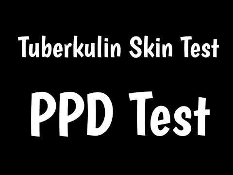 Tuberkulin Skin Test | PPD Skin Test | Mantoux Test | Diagnosis & Interpretation |