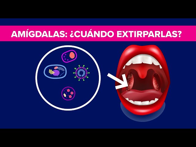 ¿Te pueden amputar un dedo por un machucón fuerte? Prevención y riesgos ...