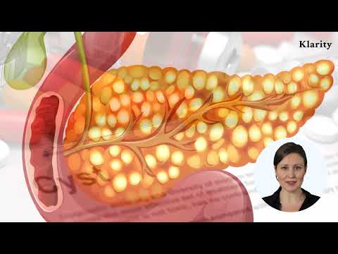 What Is A Pancreatic Cyst?