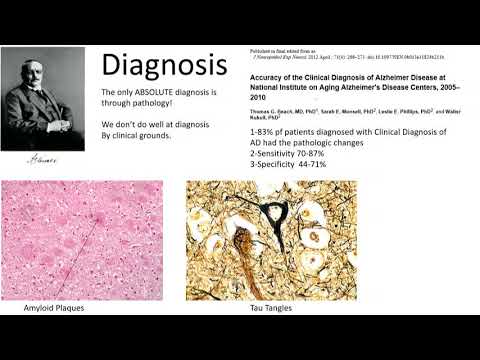 Alzheimer's Disease: Many Failed Trials, Where Do We Go From here?