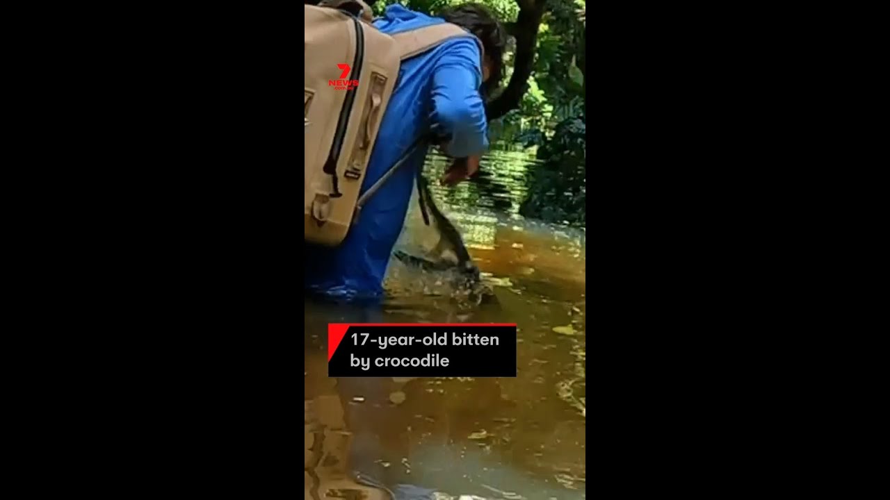 Teenager bitten by crocodile