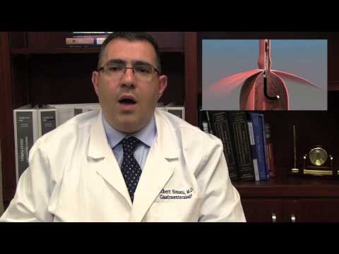 EGD explained by Dr. Gilbert Simoni