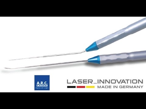 Stapedotomy using the FOX Diode Laser by A.R.C. Laser