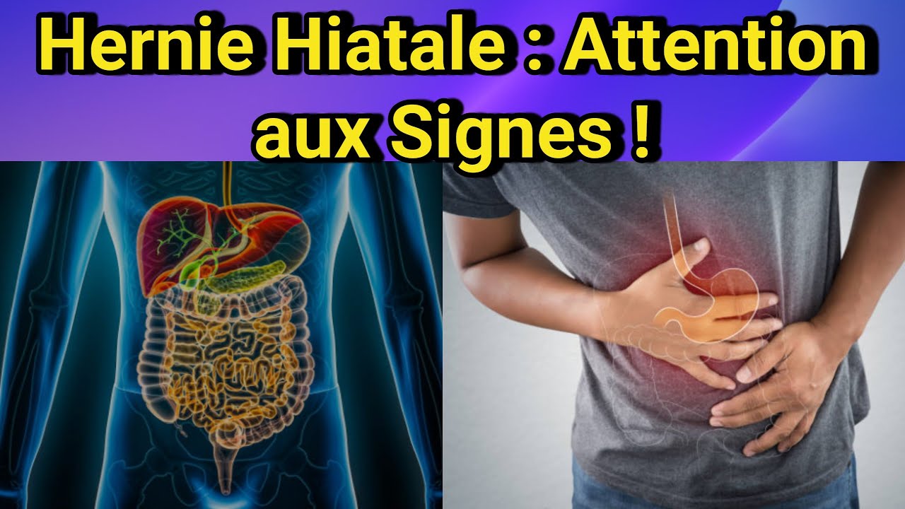 Hiatal Hernia: Symptoms, Types and Treatments – Understanding this Common Condition
