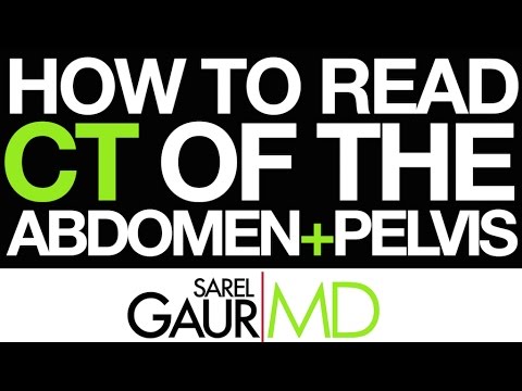 How to read CT of the abdomen and pelvis