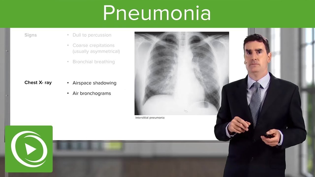 🦠 Understanding Pneumonia: Diagnosis, Types & Management