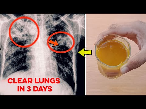 How to Remove Tar from Lungs After Smoking - Natural Recipe to Clear Lungs in 3 Days