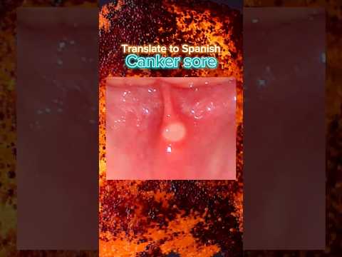 CANKER SORE Definition to SPANISH | Medical