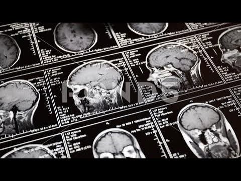 Books for radiology and imaging technology | BRIT | MRIT | HAMD KHAN