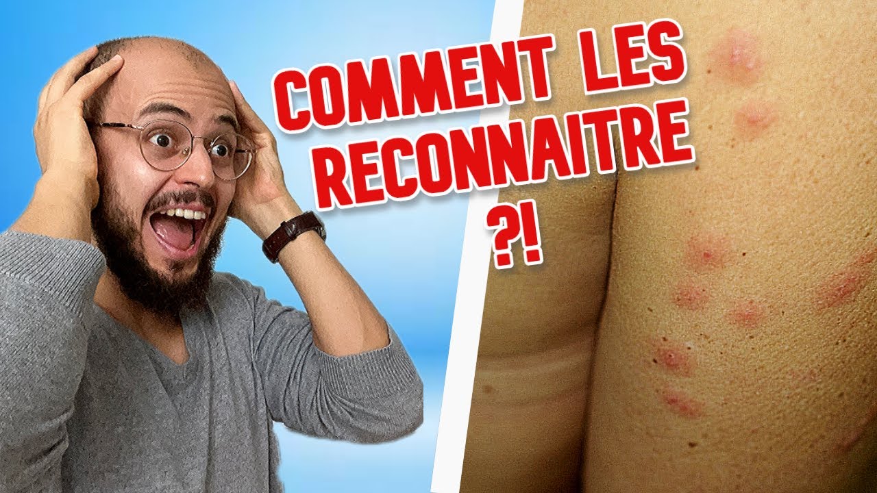 Enlever les punaises de lit : les traitements qui fonctionnent